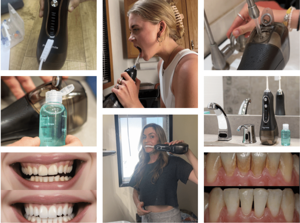 PuurSmile Water Flosser Review 2024 – 5 Best Compared